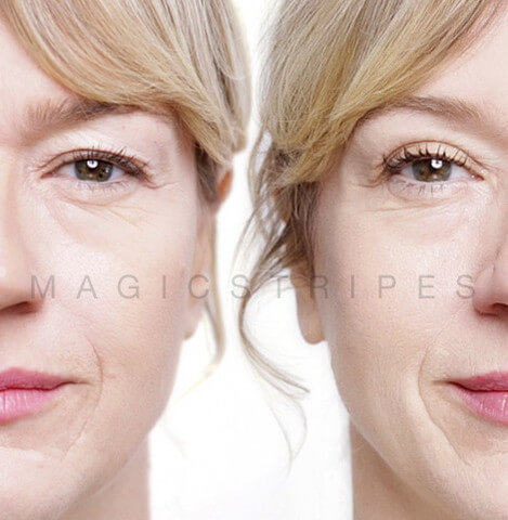 Cruelty-Free Eyelid Lifts With Magicstripes | PETA Living